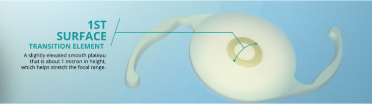 Cataract Surgery Los Angeles | Vivity Intraocular Lens | Colvard-Kandavel