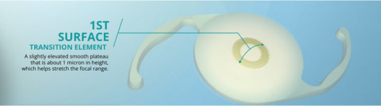 Cataract Surgery Los Angeles | Vivity Intraocular Lens | Colvard-Kandavel